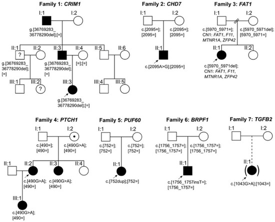 Whole Exome Sequencing in Coloboma/Microphthalmia: Identification of ...