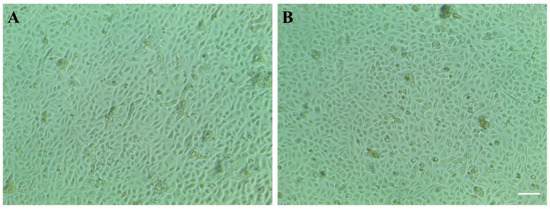 Analysis of the Differential Gene and Protein Expression Profiles of ...