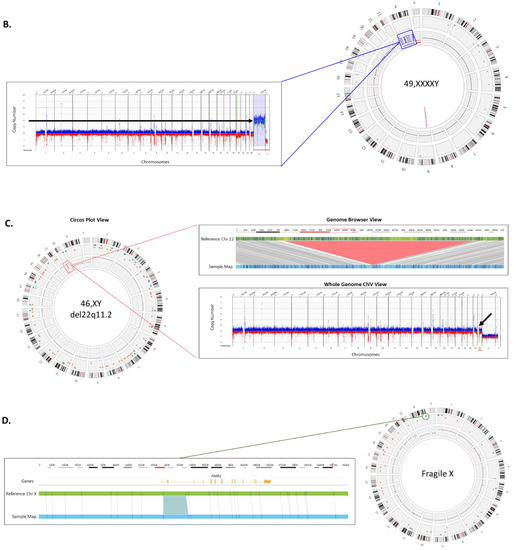 Optical Genome Mapping as a Next-Generation Cytogenomic Tool for ...