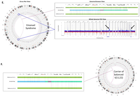Optical Genome Mapping as a Next-Generation Cytogenomic Tool for ...