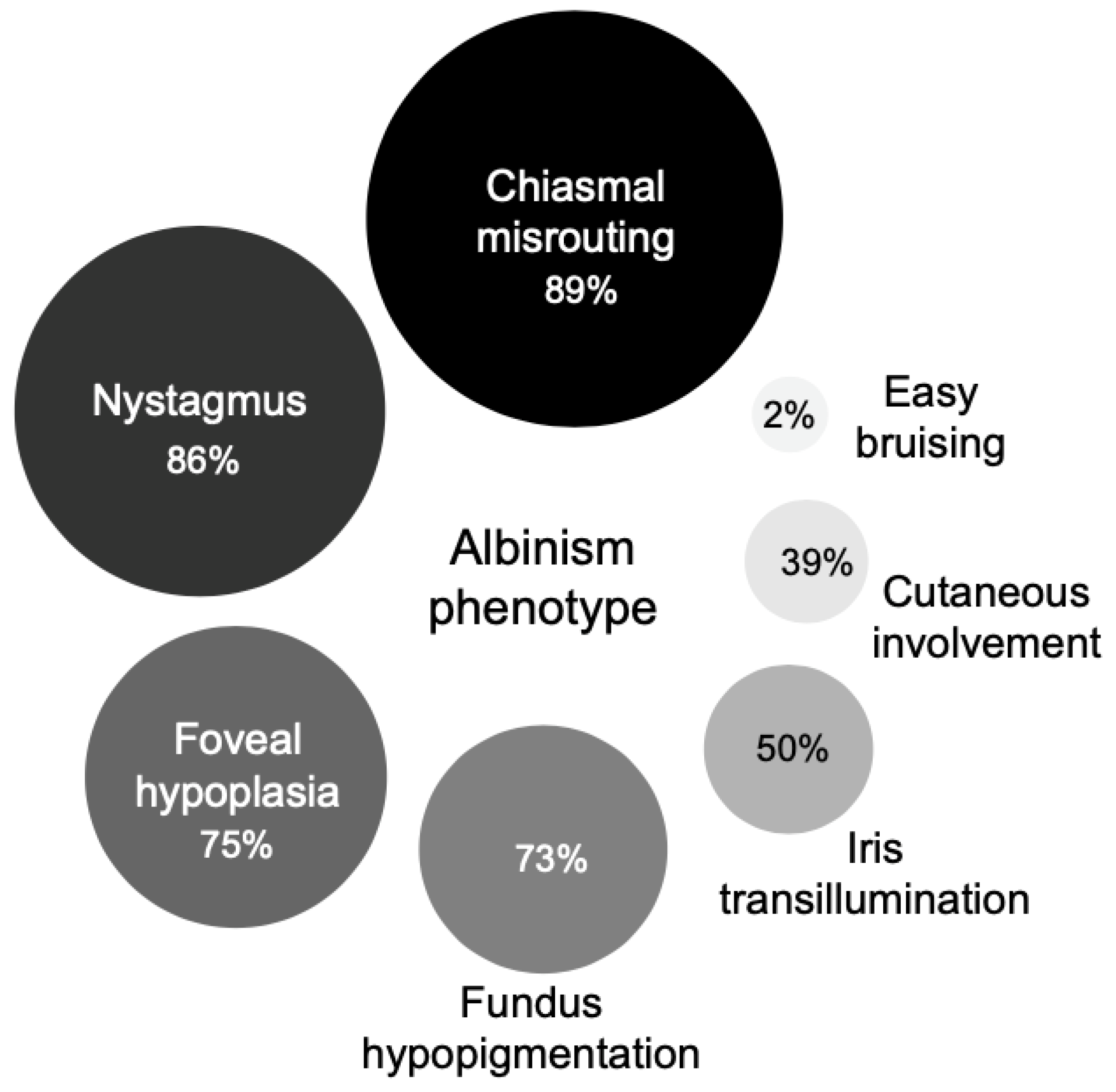 Oculocutaneous Albinism Genetics