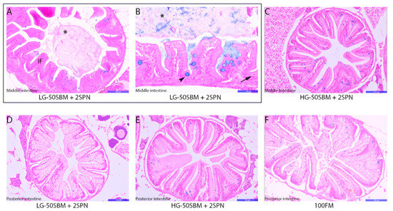 Intestinal Transcriptome Analysis Reveals Enrichment of Genes ...