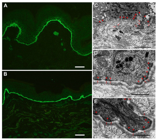 Genes | Special Issue : Genetic Variant of Genetic Skin Diseases