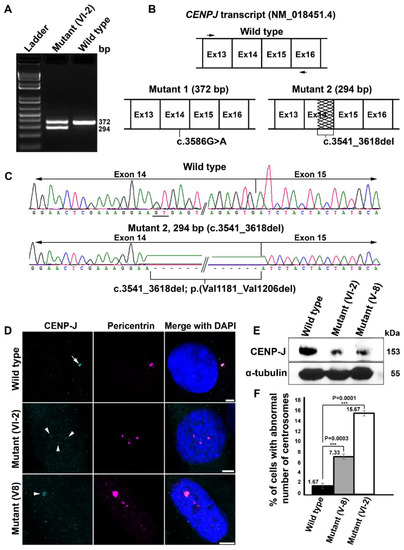 Genes | Free Full-Text | Modifier Genes in Microcephaly: A Report on ...