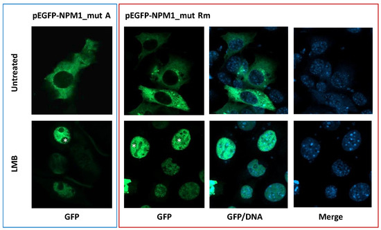 A Curious Novel Combination of Nucleophosmin (NPM1) Gene Mutations ...