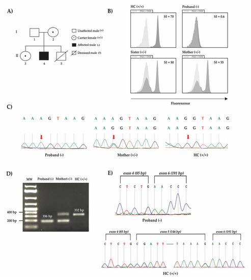 Chronic Granulomatous Disease and Myelodysplastic Syndrome in a Patient ...