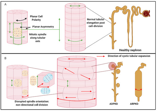 Nephronophthisis-Pathobiology and Molecular Pathogenesis of a Rare ...