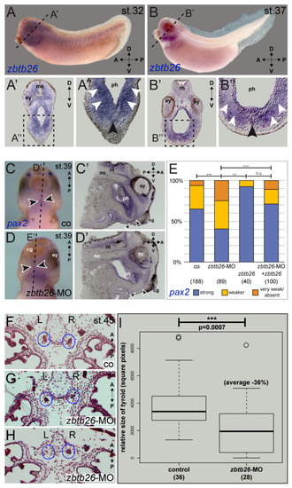 Identification of ZBTB26 as a Novel Risk Factor for Congenital ...