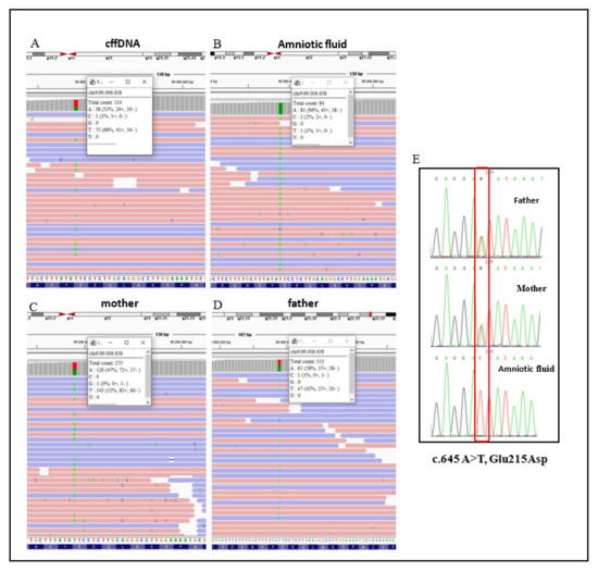 Genes Free Full Text Detection Of 46 Xy Disorder Of Sex