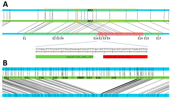 Optical Genome Mapping in Routine Human Genetic Diagnostics—Its ...