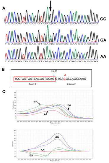 Mucolipidosis Type IV in Omani Families with a Novel MCOLN1 Mutation ...