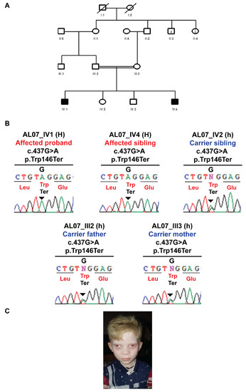 Delineating Novel and Known Pathogenic Variants in TYR, OCA2 and HPS-1 ...
