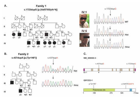 Identification of Frameshift Variants in POLH Gene Causing Xeroderma ...
