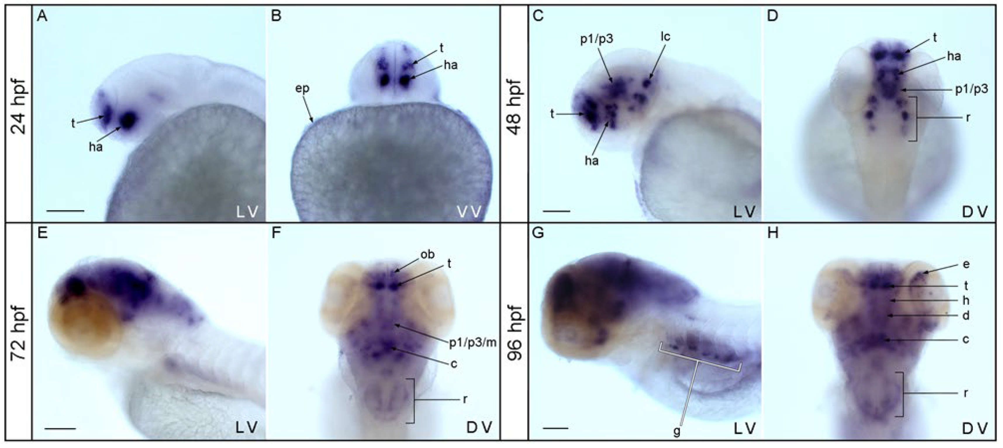 Expression Pattern of nos1 in the Developing Nervous System of Ray ...
