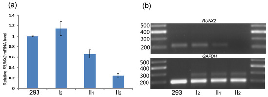 A Novel 90-kbp Deletion of RUNX2 Associated with Cleidocranial Dysplasia