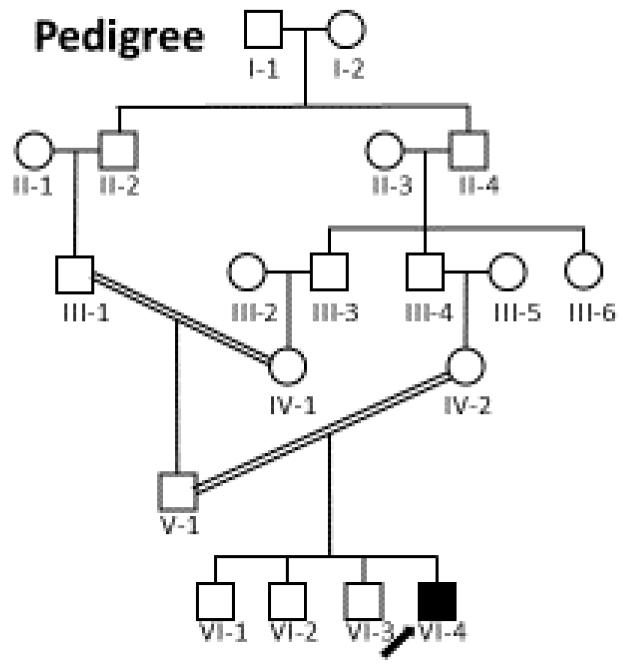 Biallelic Loss of Function Mutation in Sodium Channel Gene SCN10A in an Autism Spectrum Disorder ...