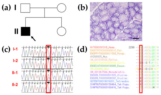 Genes | Free Full-Text | Gene Panel Sequencing Identifies a Novel RYR1 ...