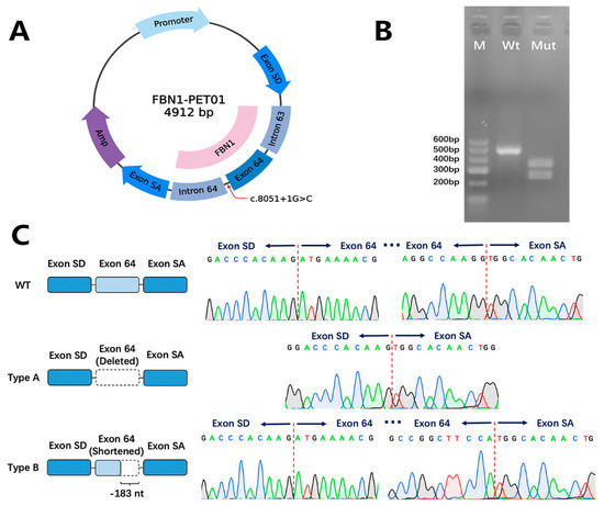 FBN1 Splice-Altering Mutations in Marfan Syndrome: A Case Report and ...