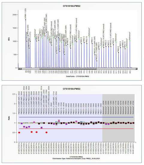 Biallelic PMS2 Mutations in a Family with Uncommon Clinical and ...