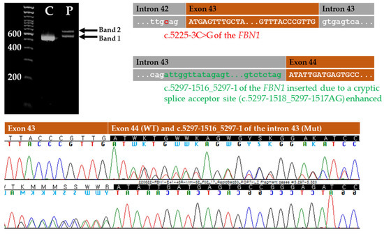 Targeted Panel Sequencing Identifies an Intronic c.5225-3C>G Variant of ...