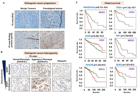 Pathophysiological Role and Diagnostic Potential of R-Loops in Cancer ...