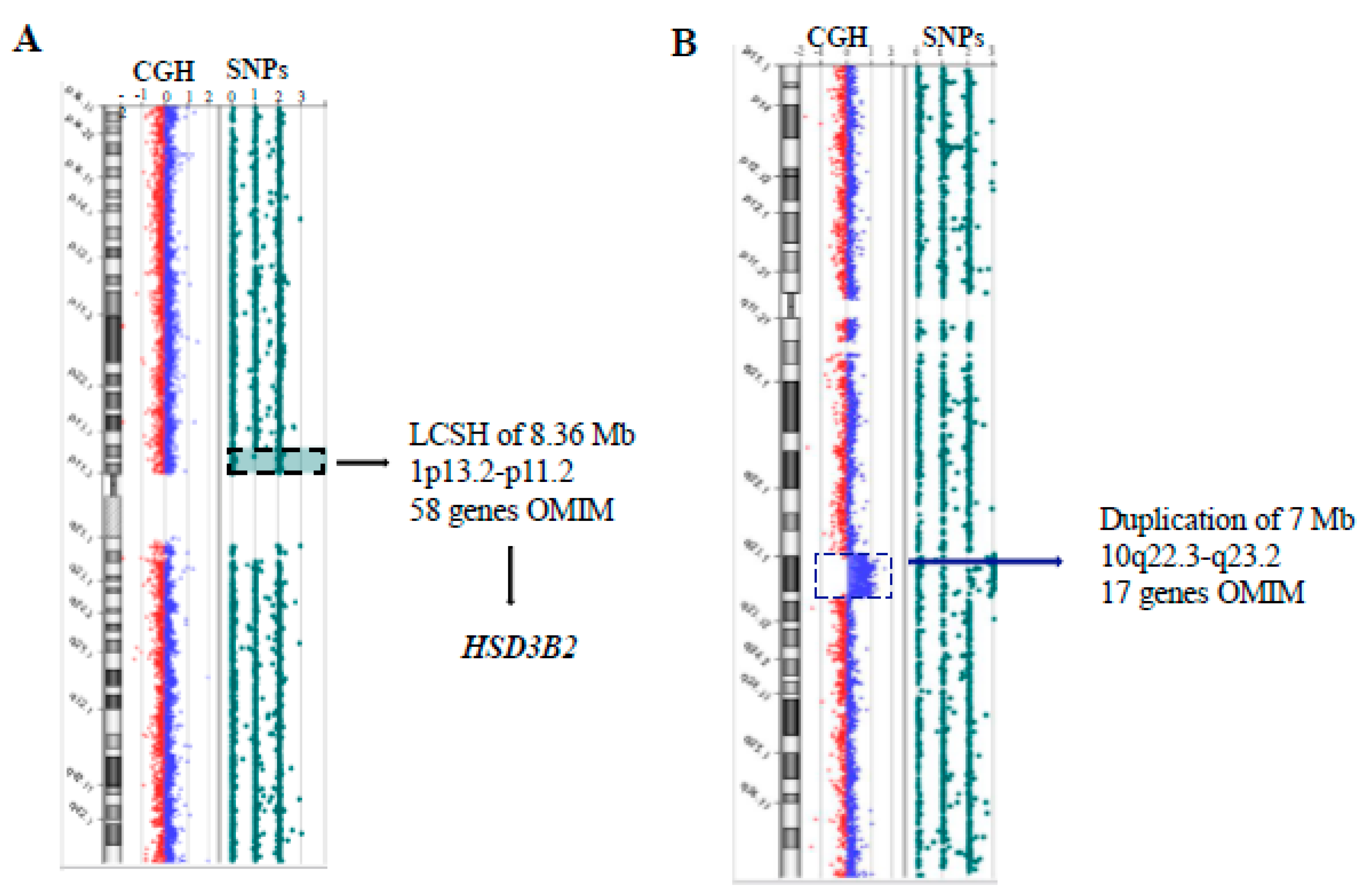 Co-Occurrence of a Pathogenic HSD3B2 Variant and a Duplication on 10q22 ...