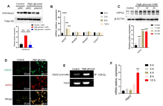 ASH2L Aggravates Fibrosis and Inflammation through HIPK2 in High ...