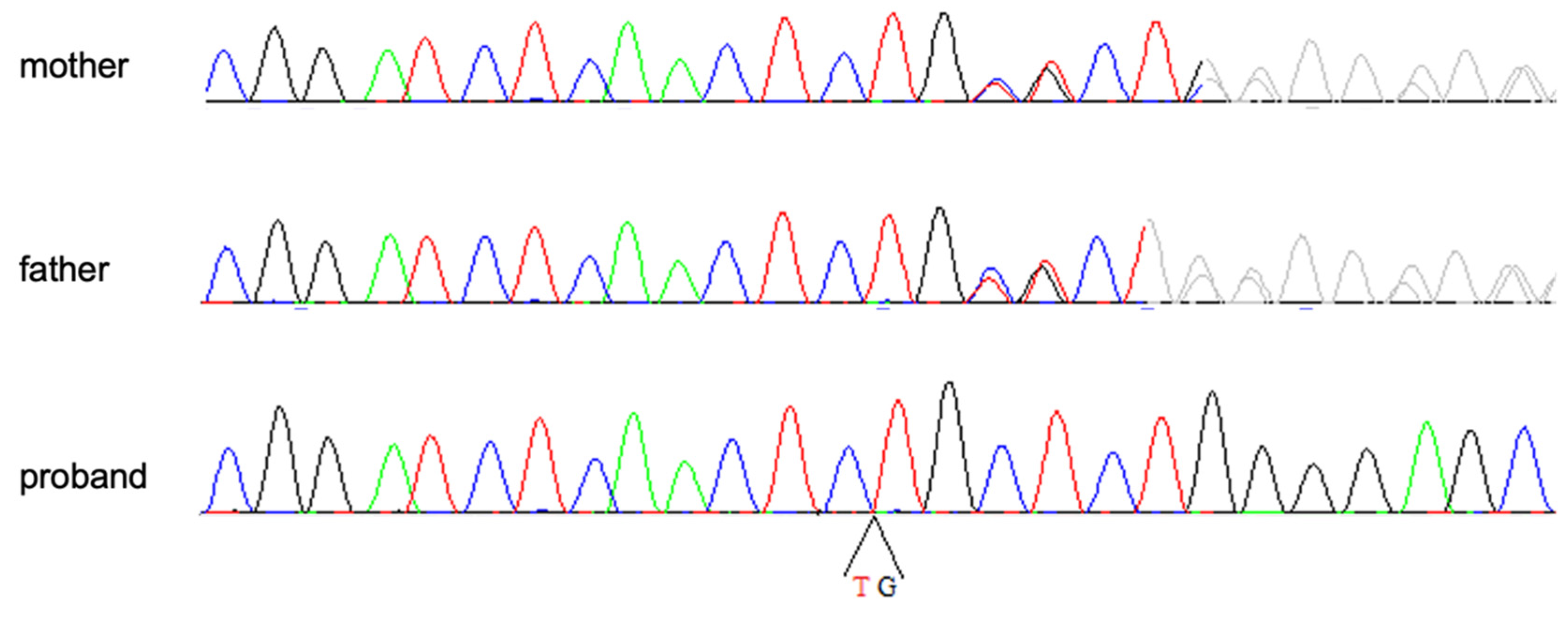 Genes | Free Full-Text | Congenital Defects in a Patient Carrying a ...