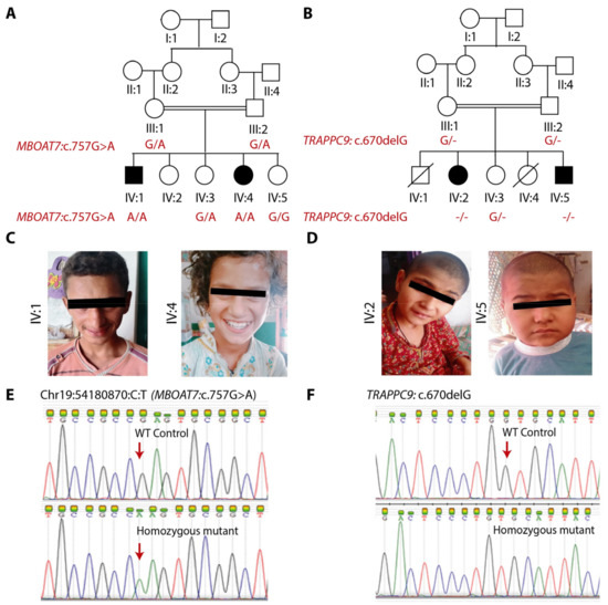 Genes | Free Full-Text | Whole-Exome Sequencing of Pakistani ... Genes | Free Full-Text | Whole-Exome Sequencing of Pakistani ...