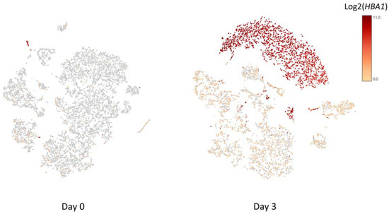 Single Cell Transcriptome Analysis of Peripheral Blood Mononuclear ...