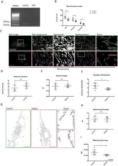 Genes | Free Full-Text | Involvement of Mitochondrial Dysfunction in ...