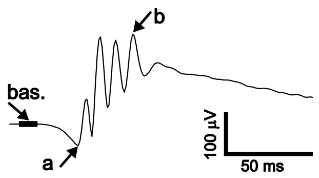OCT and ERG Techniques in High-Throughput Phenotyping of Mouse Vision