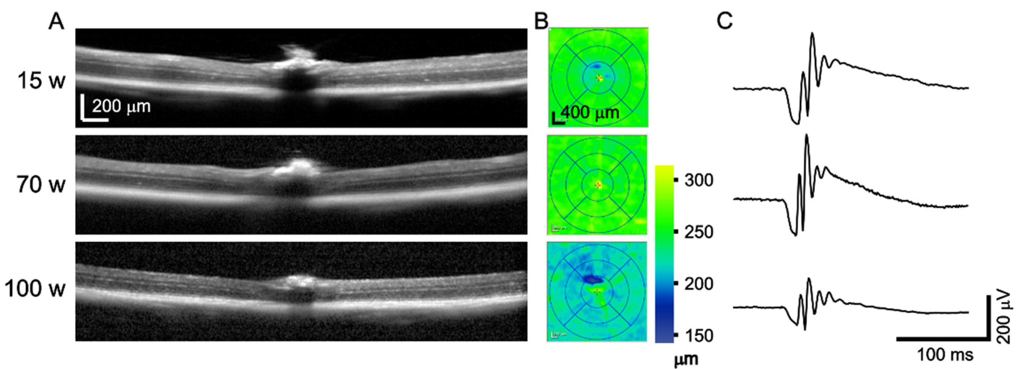 OCT and ERG Techniques in High-Throughput Phenotyping of Mouse Vision