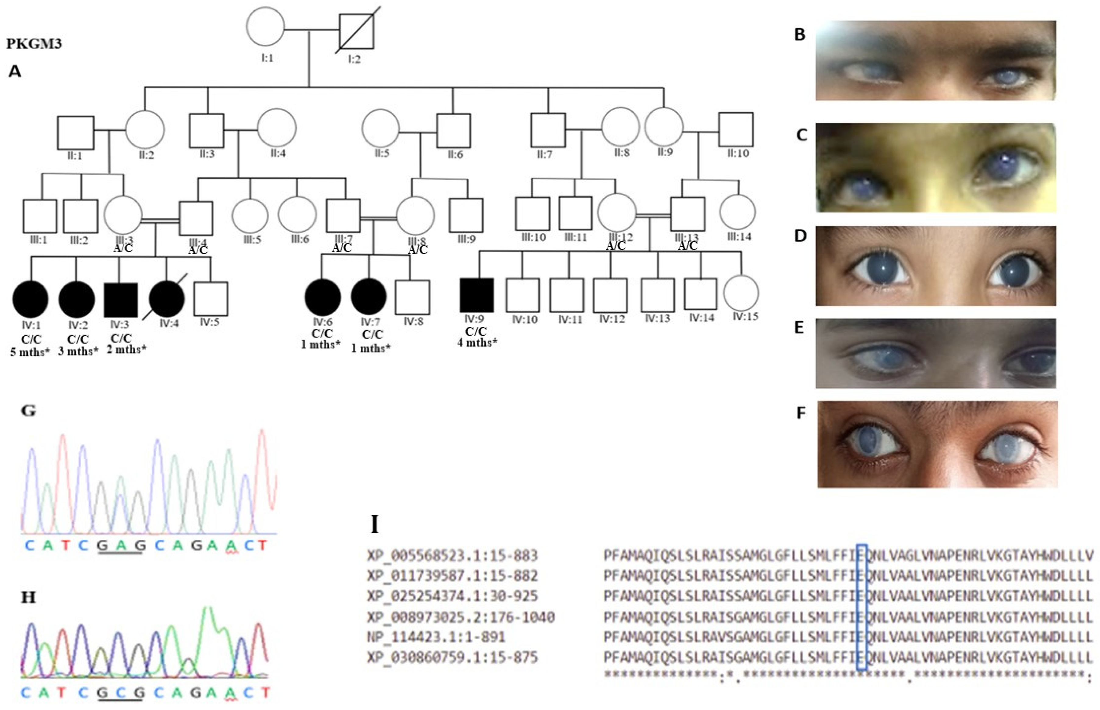 Genes Free Full Text Exome Sequencing Reveals Slc4a11 Variant
