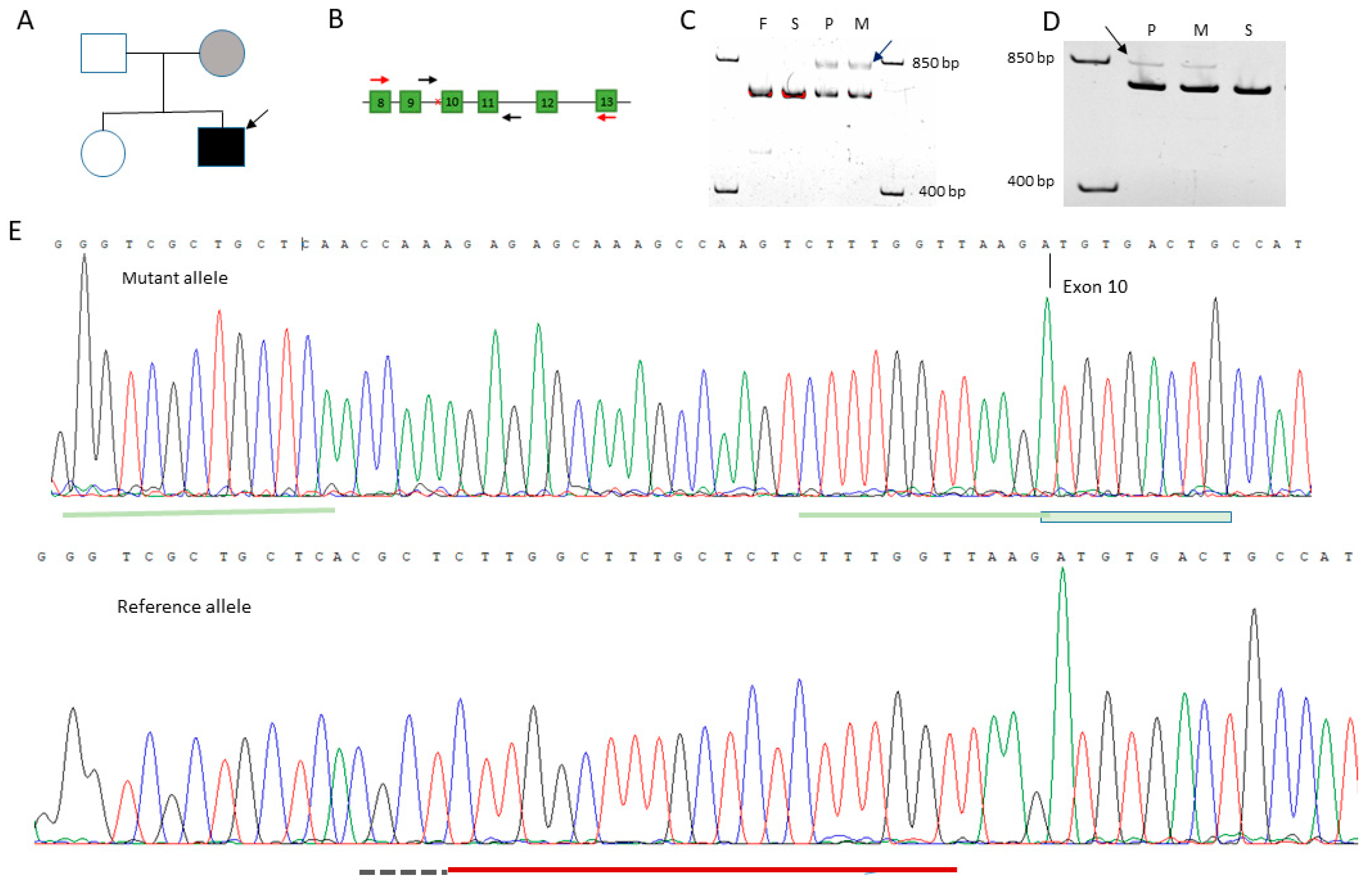 A Novel GNAS Mutation in a Patient with Ia Pseudohypoparathyroidism ...