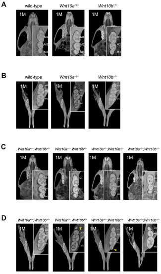 Effects of Wnt10a and Wnt10b Double Mutations on Tooth Development
