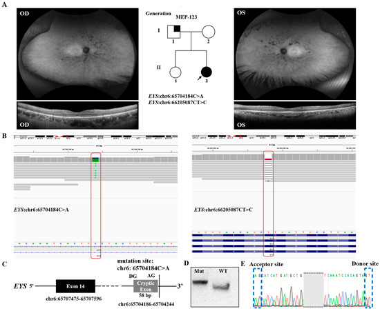 Novel Pathogenic Mutations Identified from Whole-Genome Sequencing in ...