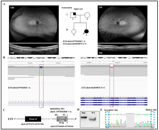 Novel Pathogenic Mutations Identified from Whole-Genome Sequencing in ...