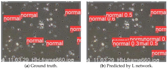 Study on Sperm-Cell Detection Using YOLOv5 Architecture with Labaled Dataset