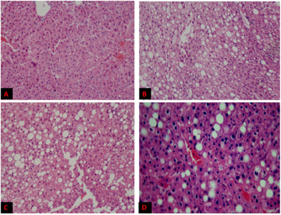 Histological and Microscopic Analysis of Fats in Heart, Liver Tissue ...