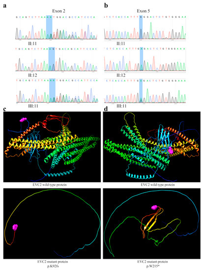 Identification of Compound Heterozygous EVC2 Gene Variants in Two ...