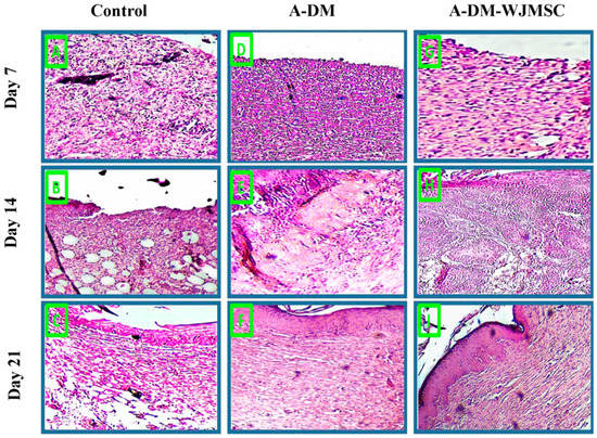 The Effect of Fetal Bovine Acellular Dermal Matrix Seeded with Wharton ...