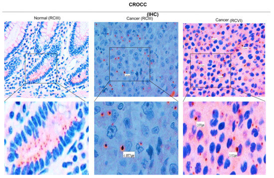 Loss of Primary Cilia Potentiates BRAF/MAPK Pathway Activation in ...