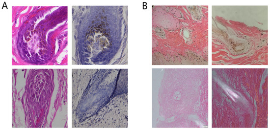 Genes | Free Full-Text | Phenotype of White Sika Deer Due to SCF Gene ...