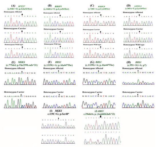 Biallelic Variants in Seven Different Genes Associated with Clinically ...