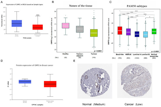 High Level of GMFG Correlated to Poor Clinical Outcome and Promoted ...