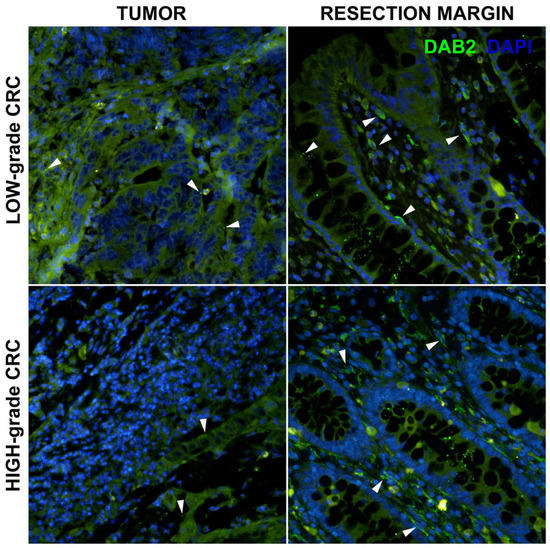 Expression Pattern of DAB Adaptor Protein 2 in Left- and Right-Side ...