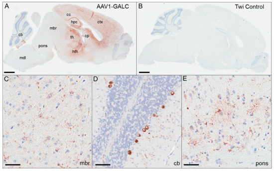 Genes | Free Full-Text | Brain Targeted AAV1-GALC Gene Therapy Reduces ...