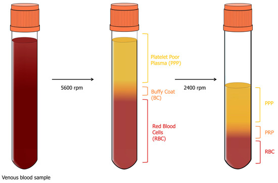 Progress in Regenerative Medicine: Exploring Autologous Platelet ...