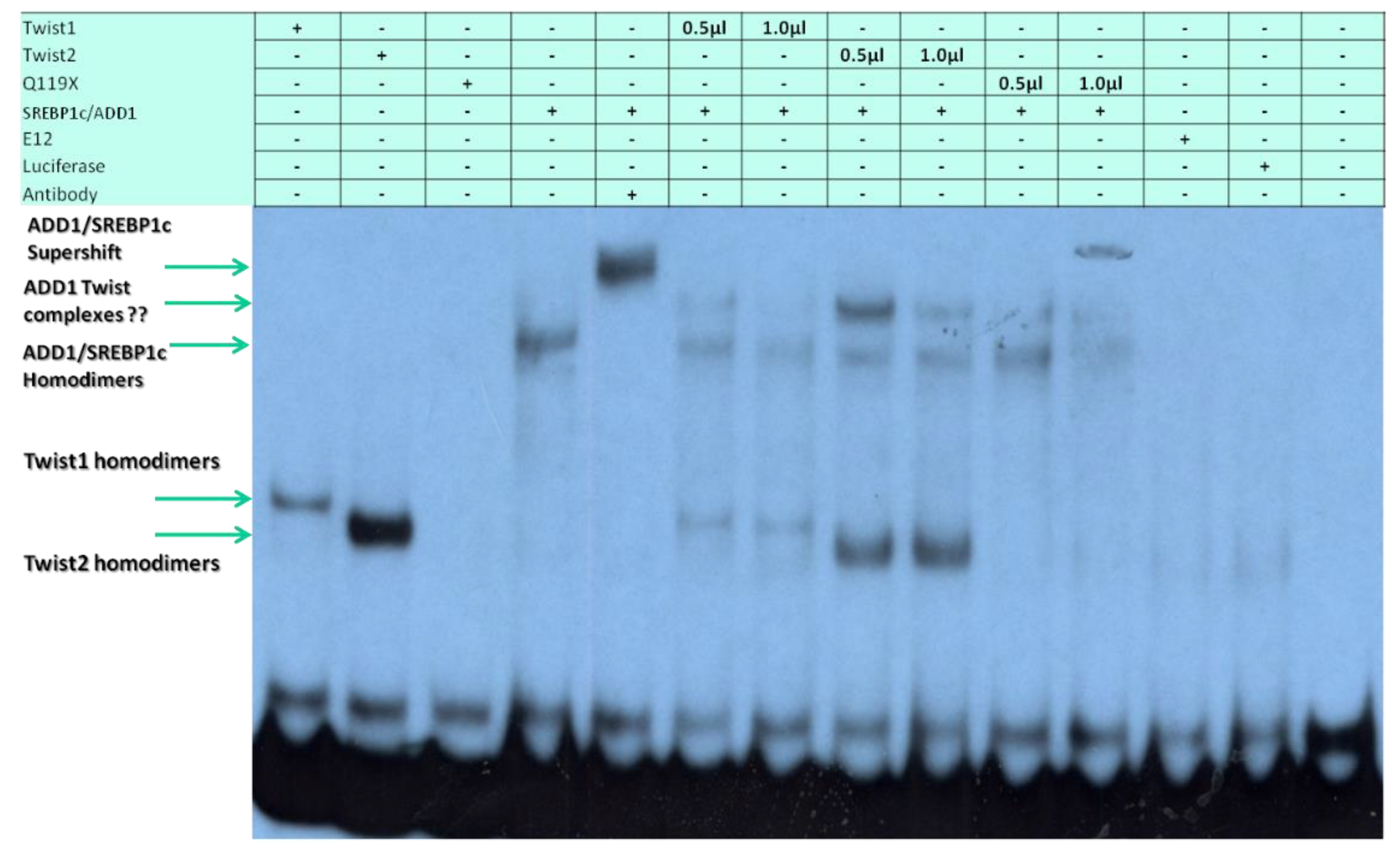 Mechanisms of Regulation of the CHRDL1 Gene by the TWIST2 and ADD1 ...